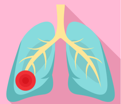 Vacina contra a pneumonia - Dr. Breno Gusmão - Onco-Hematologista